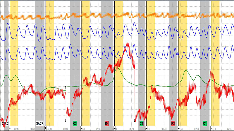 Rassie Erasmus Consulting – Forensic | Psycho | Physiologist